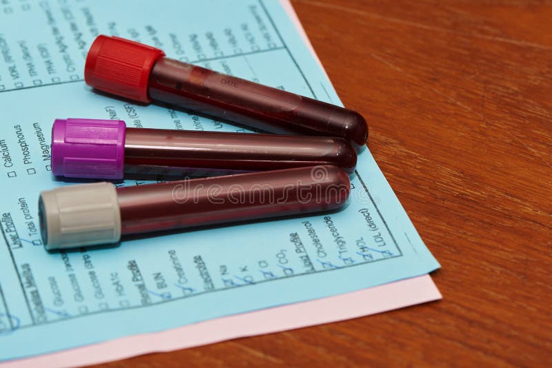 Three Blood Samples in Test Tubes and Paper Request Form Stock Image ...
