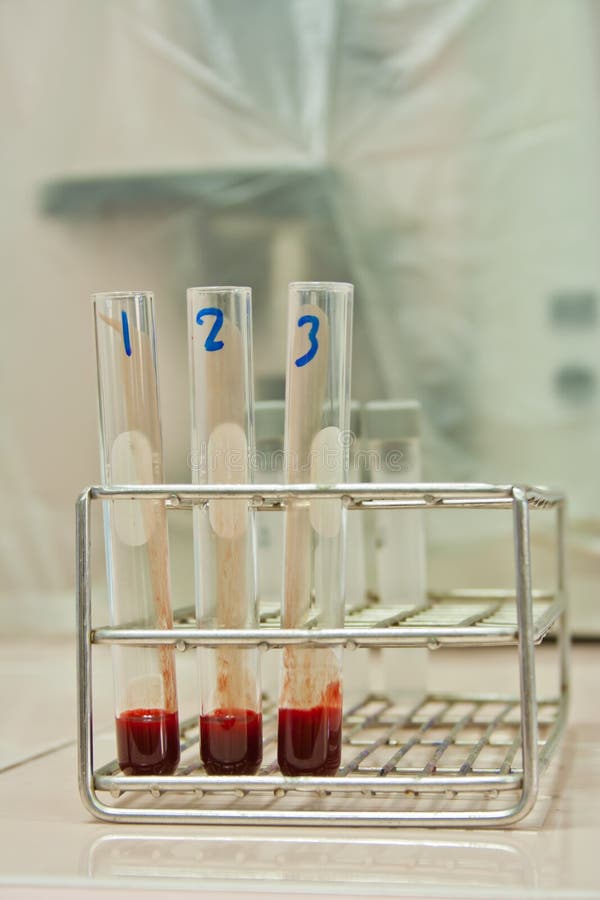 Three Blood Tubes in Laboratory Room Stock Photo - Image of ...