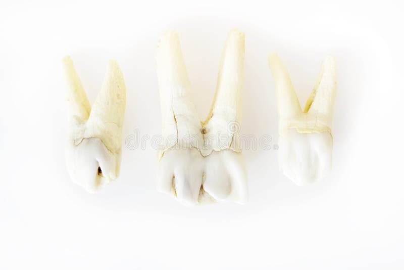 Three Cow S Teeth with Roots on a White Background. Stock Image - Image ...