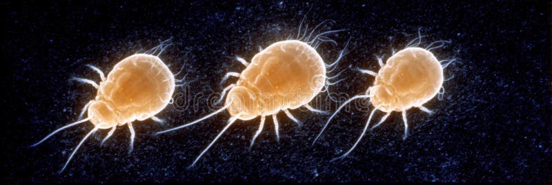 Dust Mites Under Microscopic View Revealing Their Unique Structure and ...