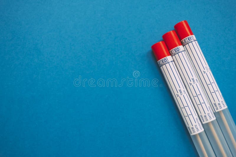 Three Laboratory Sample Tubes with Red Cap on Blue Background Stock ...