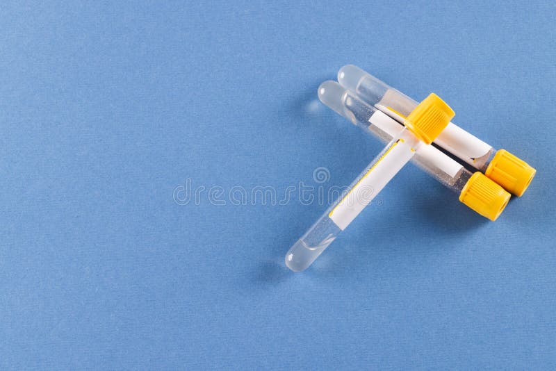 Three Sample Tubes of Clear Fluid with Yellow Lids, on Blue Background ...