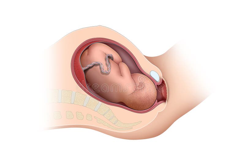 Common Way of Childbirth is a Vaginal Delivery Stock Illustration ...