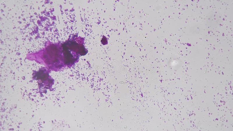 Three Types of Bacteria are Filmed Under Microscope Against Bright ...