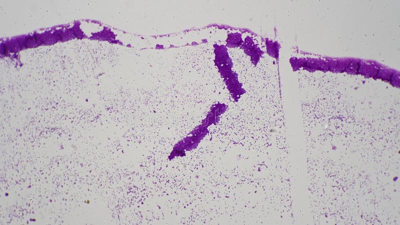 Three Types of Bacteria are Filmed Under Microscope Against Bright ...