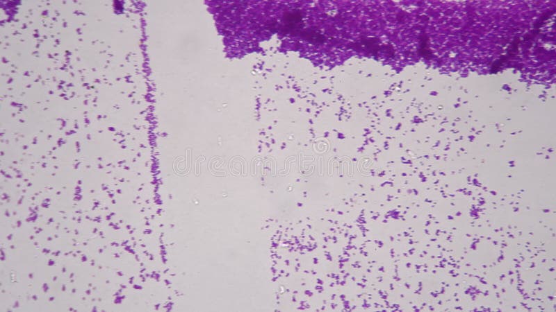 Three Types of Bacteria are Filmed Under Microscope Against Bright ...