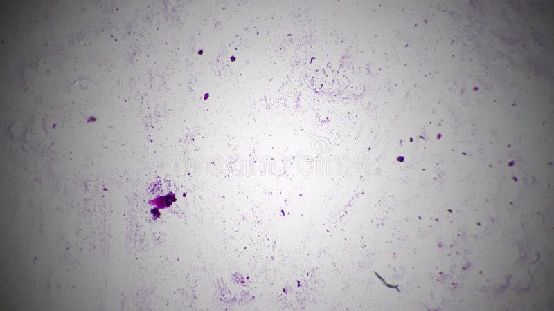 Three Types of Bacteria are Filmed Under Microscope Against Bright ...