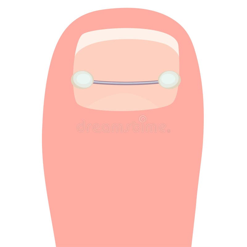 Toenail Cartoon Stock Illustrations – 256 Toenail Cartoon Stock ...