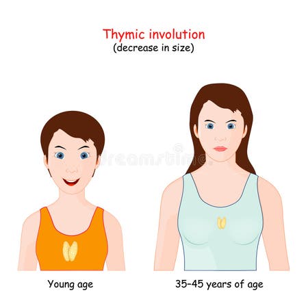 Thymic Involution. Decrease Size of the Thymus with Age Stock Vector ...