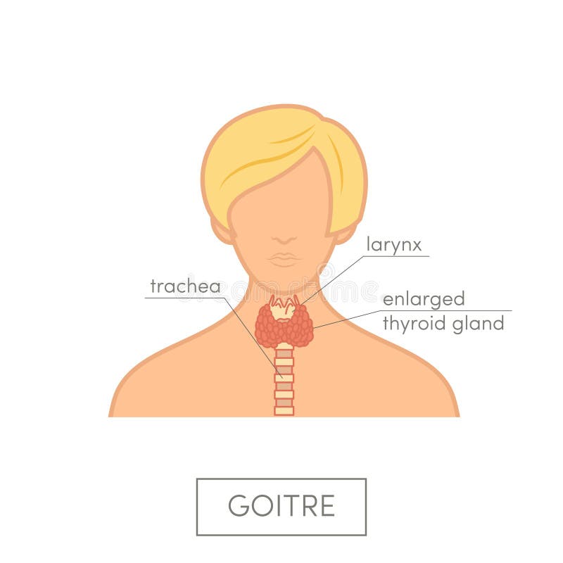 Thyroid Gland Anatomy Of Female Stock Illustration Illustration Of
