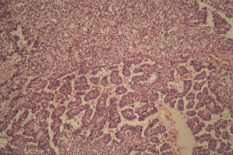 Thyroid Gland Cells Under the Microscope Stock Photo - Image of ...