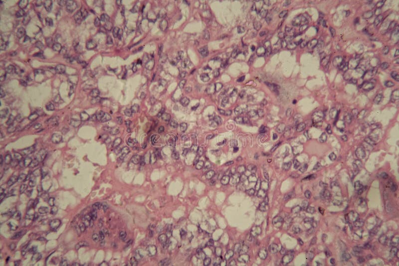 Thyroid Gland Cells Under the Microscope Stock Photo - Image of ...