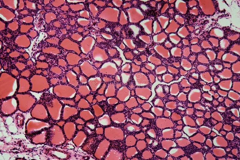 Thyroid Gland Cells Under the Microscope Stock Photo - Image of ...