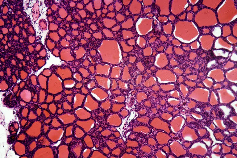 Thyroid Gland Cells Under the Microscope Stock Image - Image of health ...