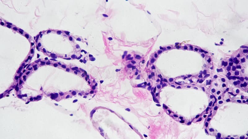 Thyroid Gland Of The Human In Section Filmed Under Microscope 400x Against Bright Field Stock