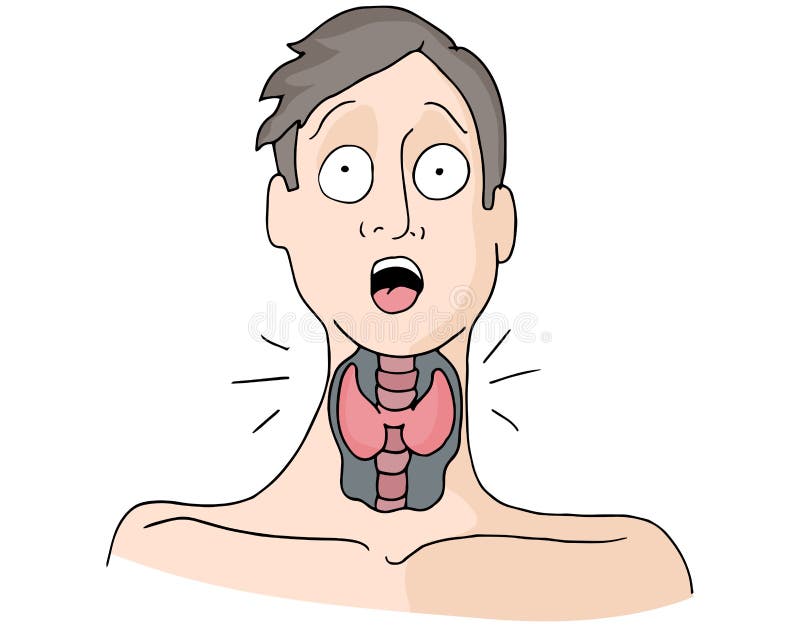 Thyroid Medical Condition Man Stock Vector - Illustration of vector ...