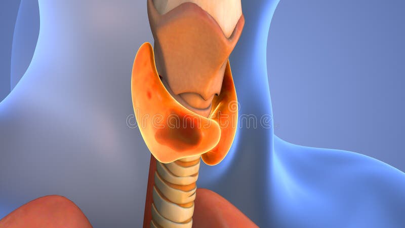 Many Thyroid Nodules Stock Illustrations – 3 Many Thyroid Nodules Stock ...