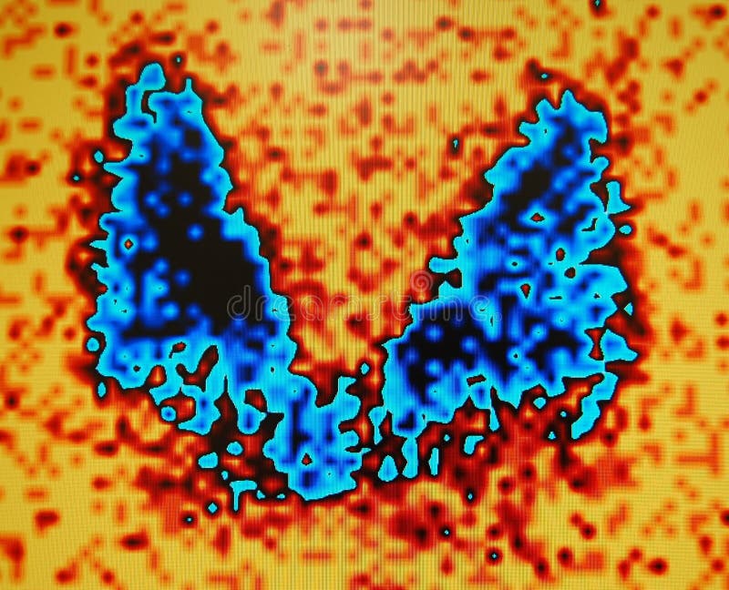 Normal Tsh Level Woman Stock Photos - Free & Royalty-Free Stock Photos ...