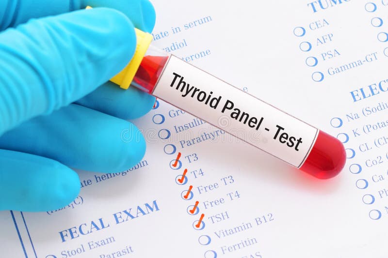 Thyroid panel test stock photo. Image of hormone, medicine - 101272648