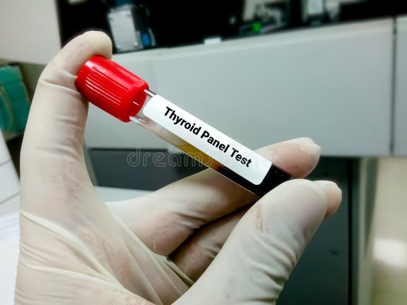 Thyroid panel test stock photo. Image of hyperthyroidism - 275614294