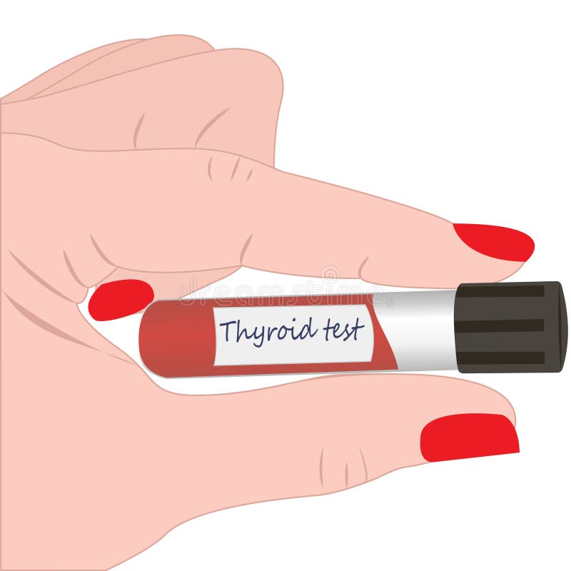 Thyroid Healthy and Enlarged Thyroid. Hypothyroid Vector Illustration ...