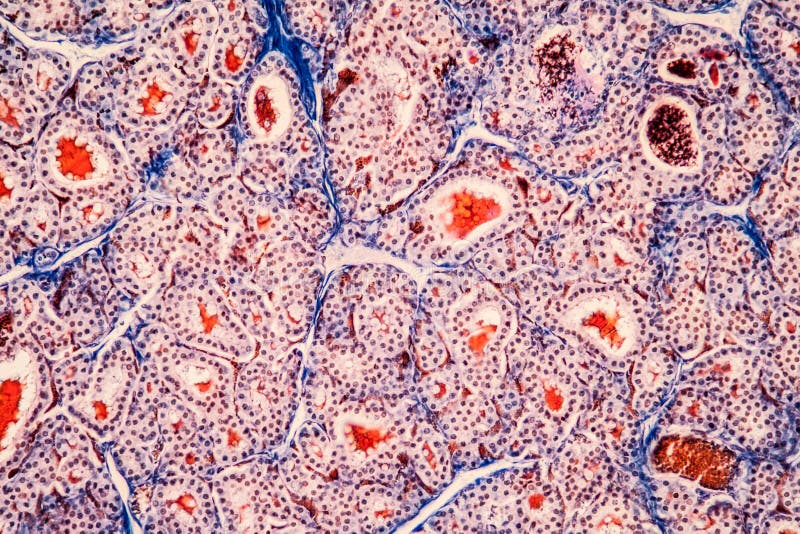 Thyroid tissue stock photo. Image of microscopy, research - 196730588
