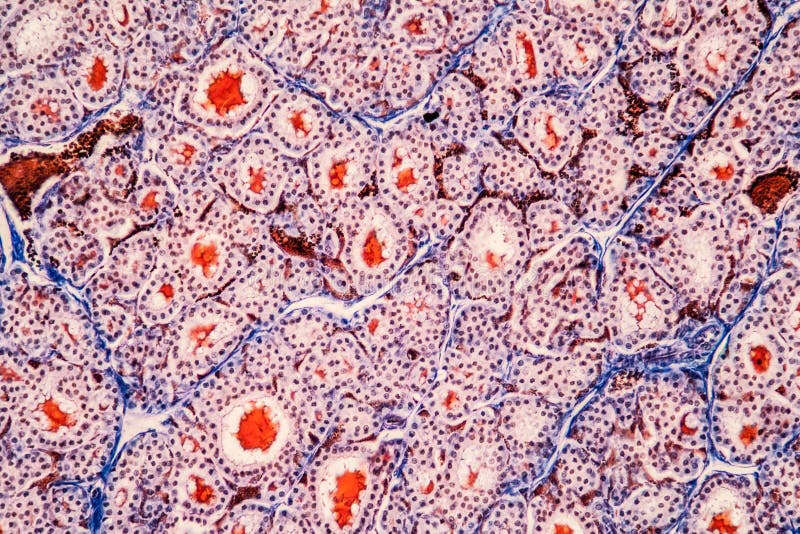 Thyroid tissue stock photo. Image of hormones, glass - 196730634