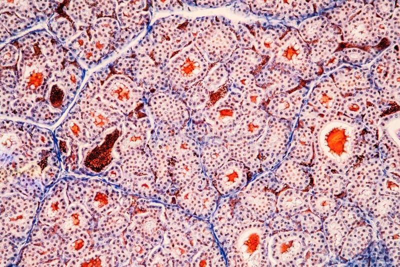 Thyroid tissue stock image. Image of microscopy, magnifying - 196730717
