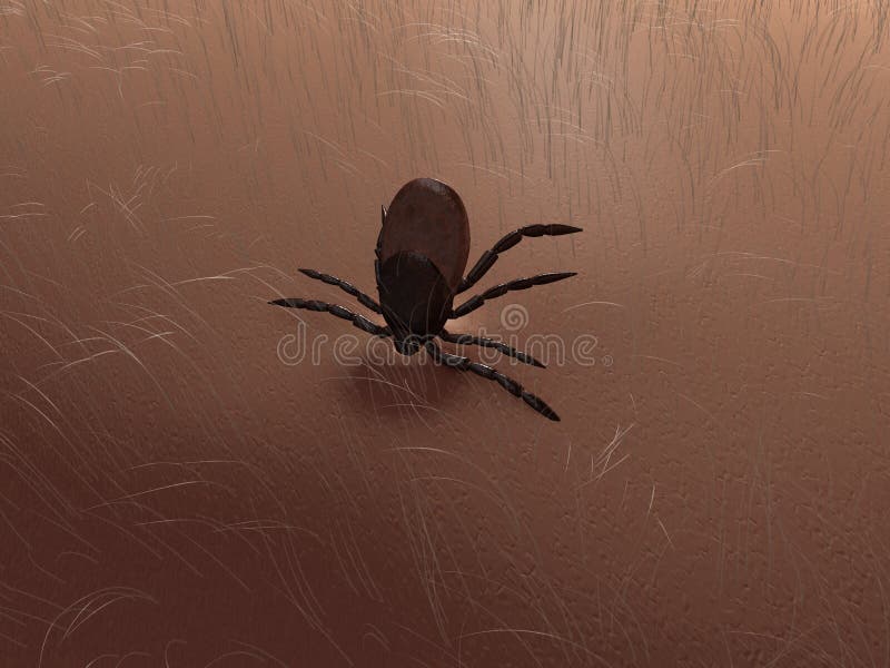 Tick bite stock illustration. Illustration of disease - 3399838