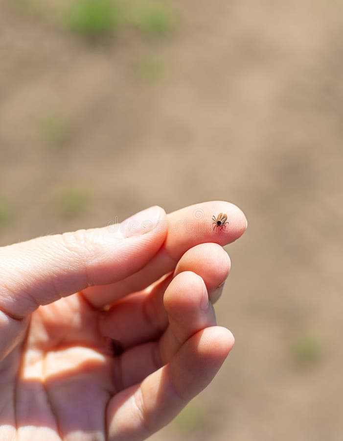 Tick on a Human Hand. Selective Focus Stock Photo - Image of skin, bite ...