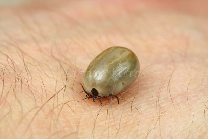 Tick on skin with hair stock photo. Image of education - 35435930