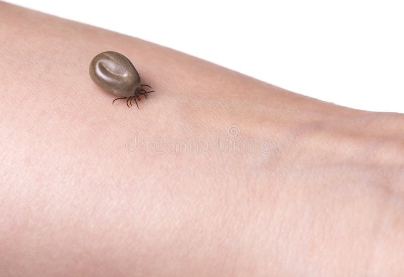 Tick on a skin stock photo. Image of human, pest, parasite - 55557414