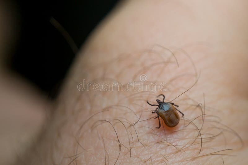 Tick on skin surface stock image. Image of blood, hair - 136613317