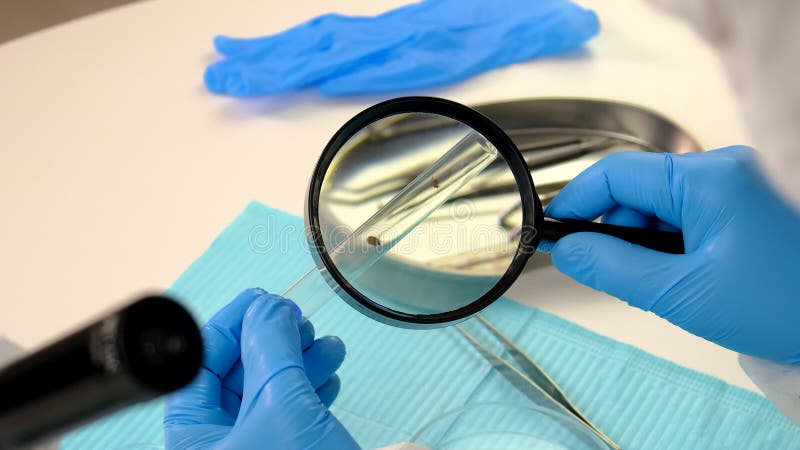 Tick in a Test Tube in the Laboratory. Selective Focus Stock Footage ...