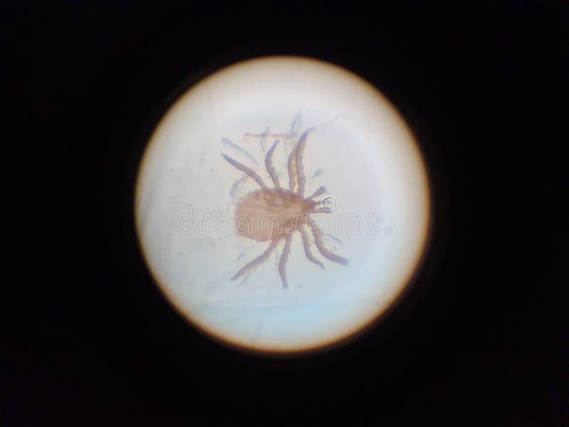 Tick under microscope stock photo. Image of miniature - 232599028