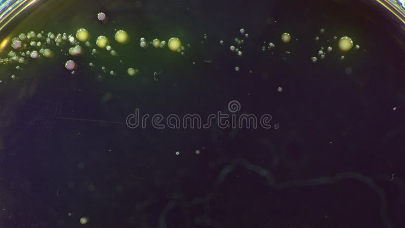 Time Lapse of Bacterial Colony Growth in a Petri Dish Stock Video ...