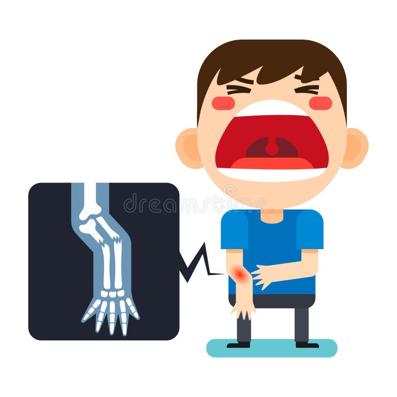 Tiny Cute Cartoon Patient Man Character Broken Right Arm in Gypsum ...