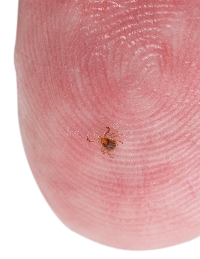 Tiny Deer Tick on Finger Tip of Man Stock Image - Image of infectious ...