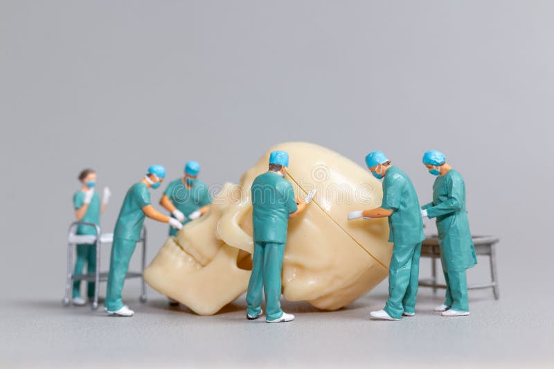 Miniature Surgeons Operating on Human Skull Model Stock Photo - Image ...