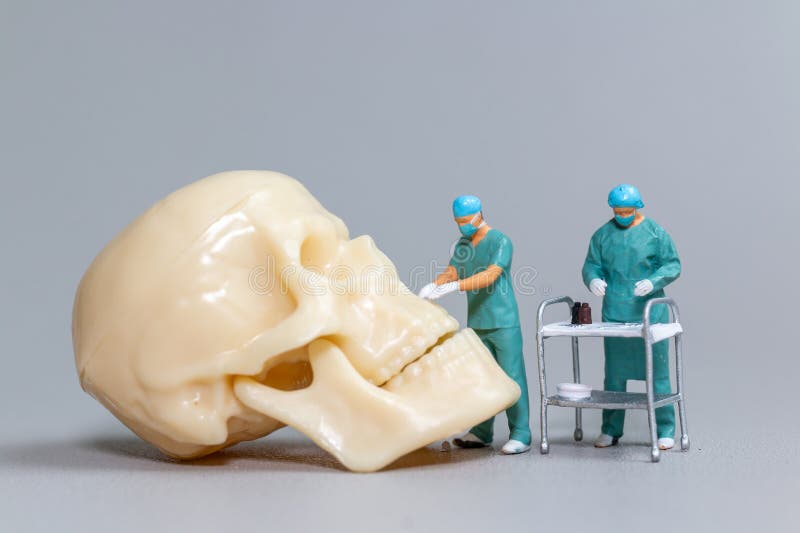 Miniature Surgeons Operating on Human Skull Model Stock Photo - Image ...