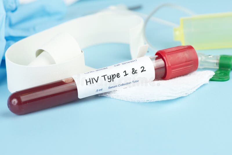Tipo 1 e 2 di HIV immagine stock. Immagine di liquido - 51542381