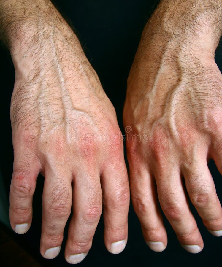 Tired hands stock photo. Image of senior, beauty, finger - 2496266