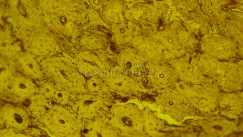 Tissu D'un Os Compact Sous Le Microscope 400 X Image stock - Image du ...