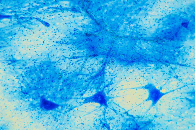 Cellule Microscopique - Tissu Neuronal Image stock - Image du neurone ...