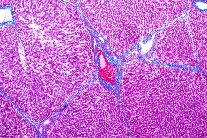 Tissue of Liver Under the Microscope for Education. Stock Image - Image ...