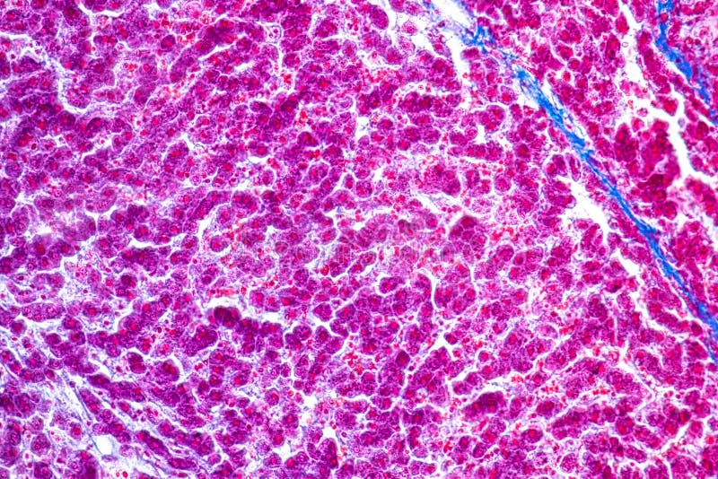 Tissue Of Liver Under The Microscope For Education. Stock Image - Image ...