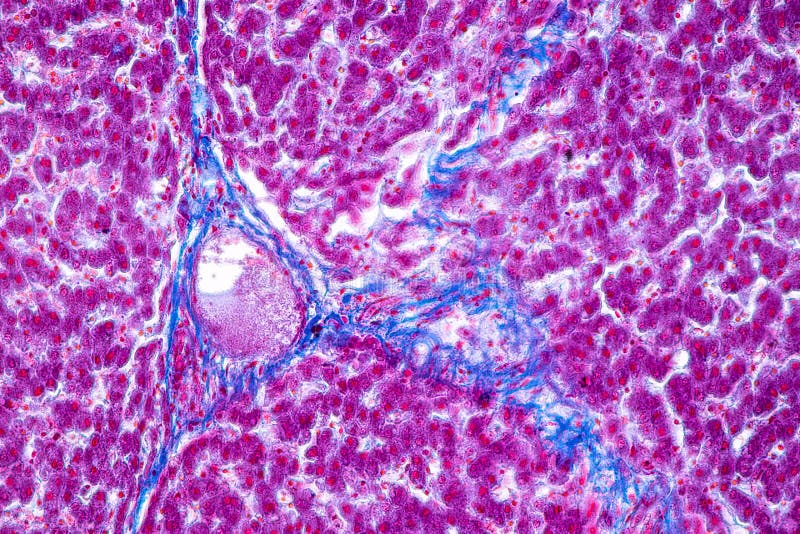Tissue of Liver Under the Microscope for Education. Stock Image - Image ...