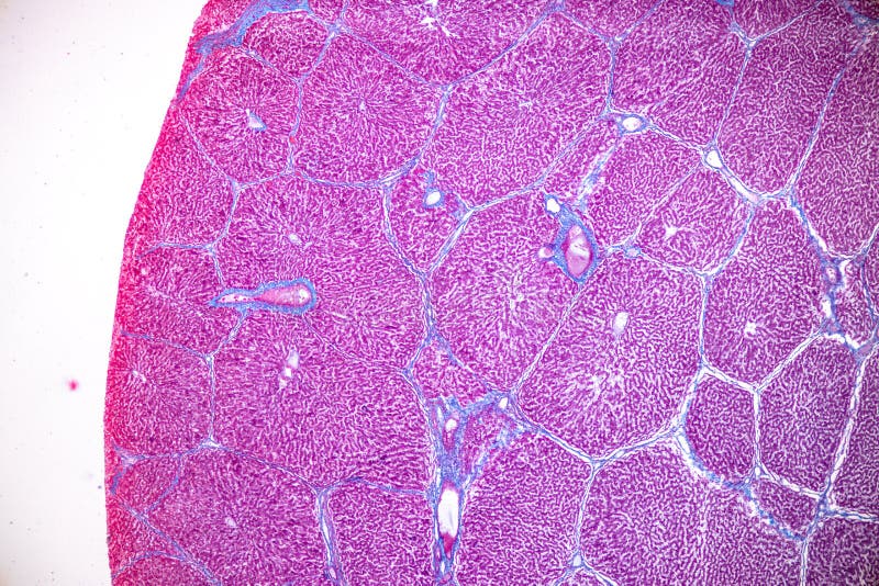 Tissue of Liver Under the Microscope for Education. Stock Image - Image ...