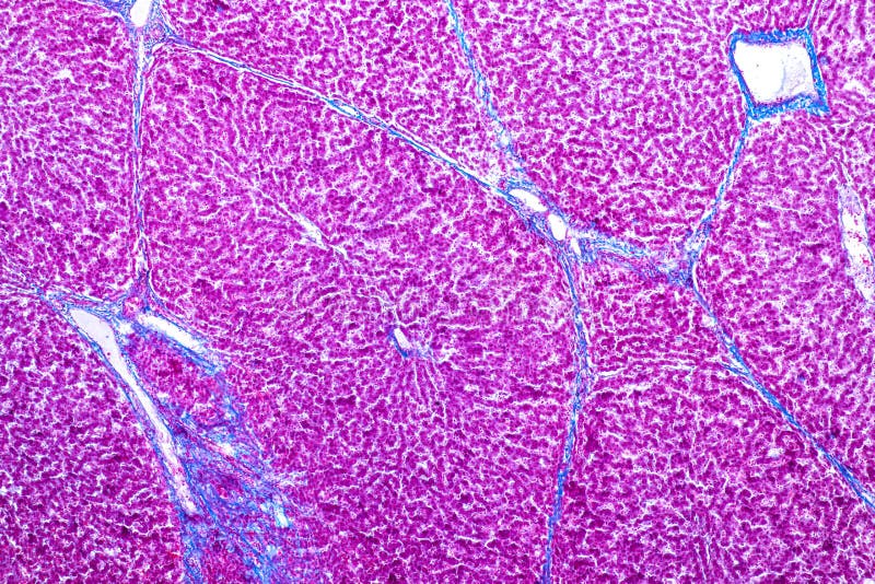 Tissue of Liver Under the Microscope for Education. Stock Photo - Image ...