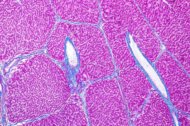 Tissue of Liver Under the Microscope for Education. Stock Photo - Image ...